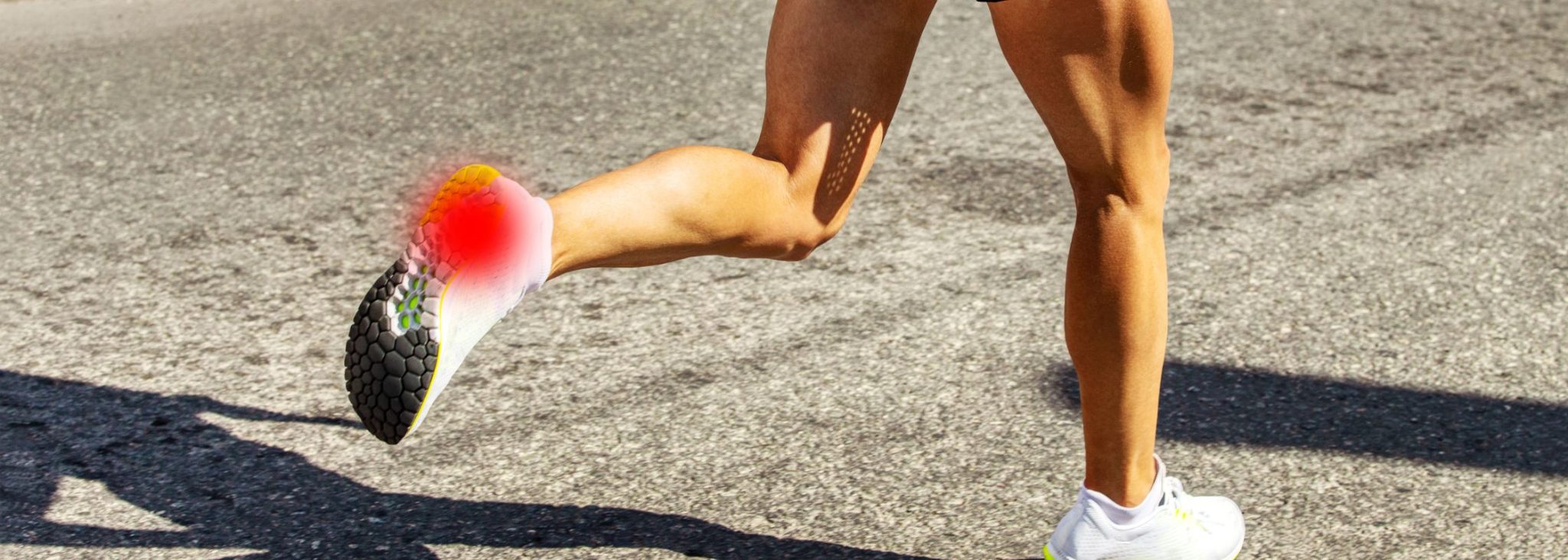 Heel Pain With Running - What to Do? | Central Performance